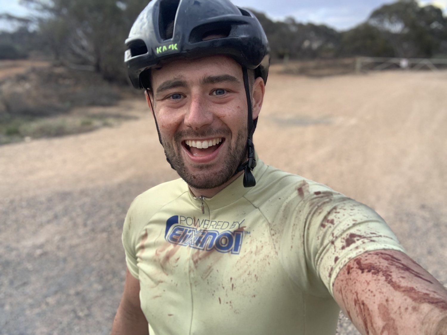Josh Quigley Interview – pedalnorth
